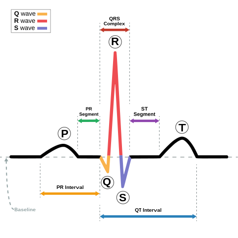 How to reliably perform an ECG part 1: getting a good quality trace ...