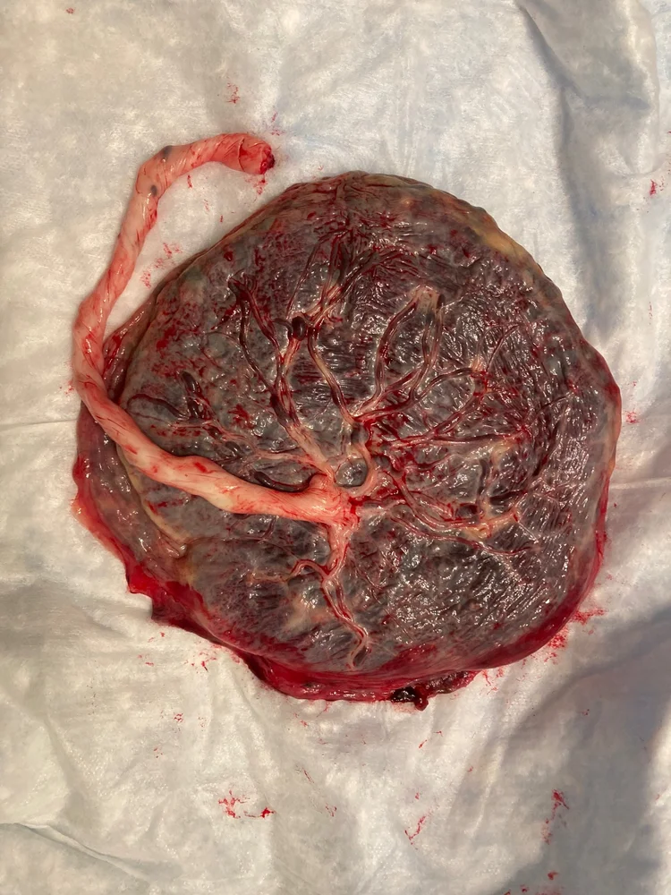 Birth of the Placenta - a physiological approach — Lennon Clark, CPM ...