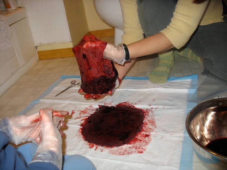Birth of the Placenta - a physiological approach — Lennon Clark, CPM ...
