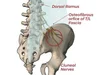 Maigne Syndrome: Sciatica of the Thoraco-Lumbar Junction — ChiroUp