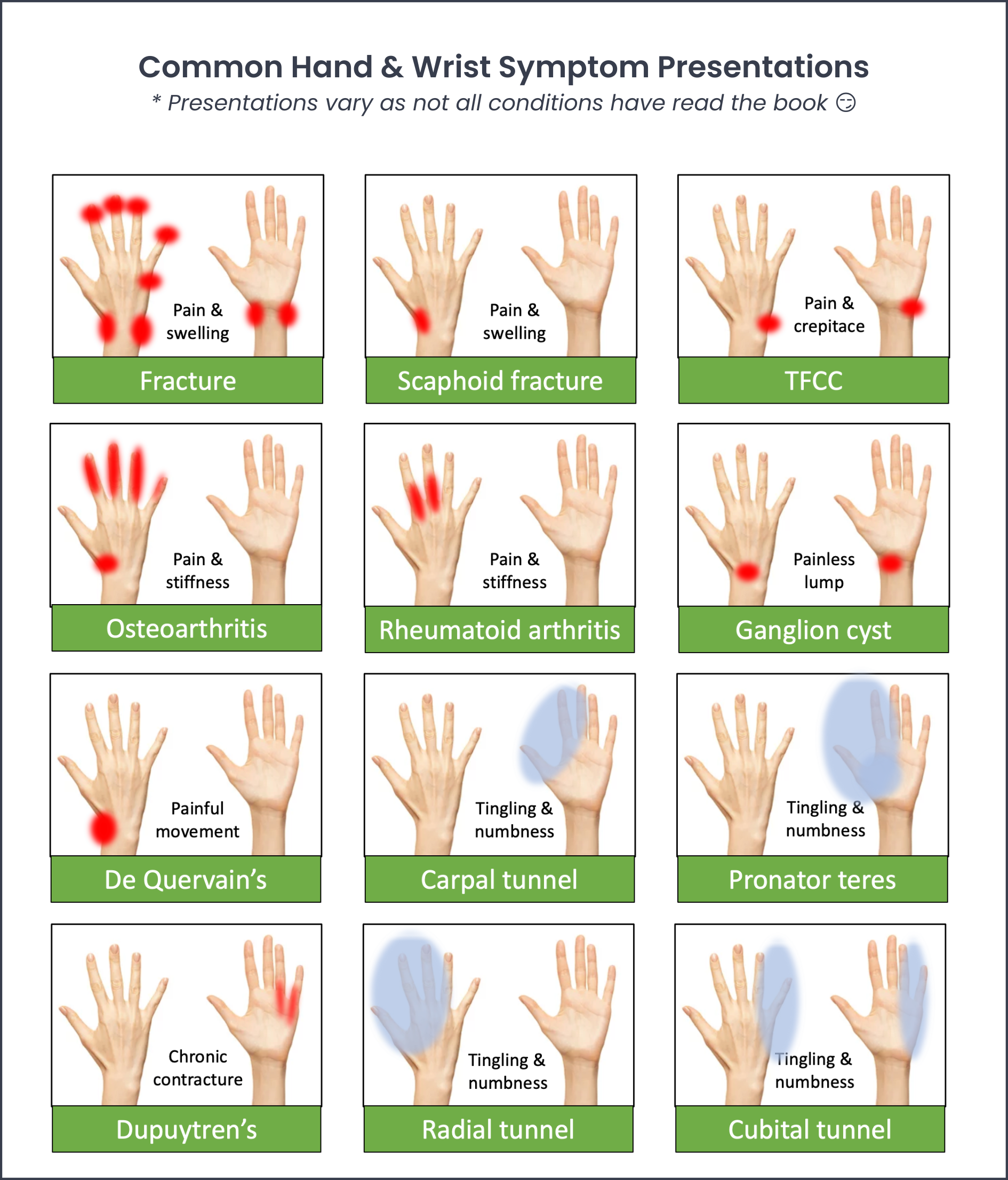 Hand Swelling Numbness And Pain – NOSXAT