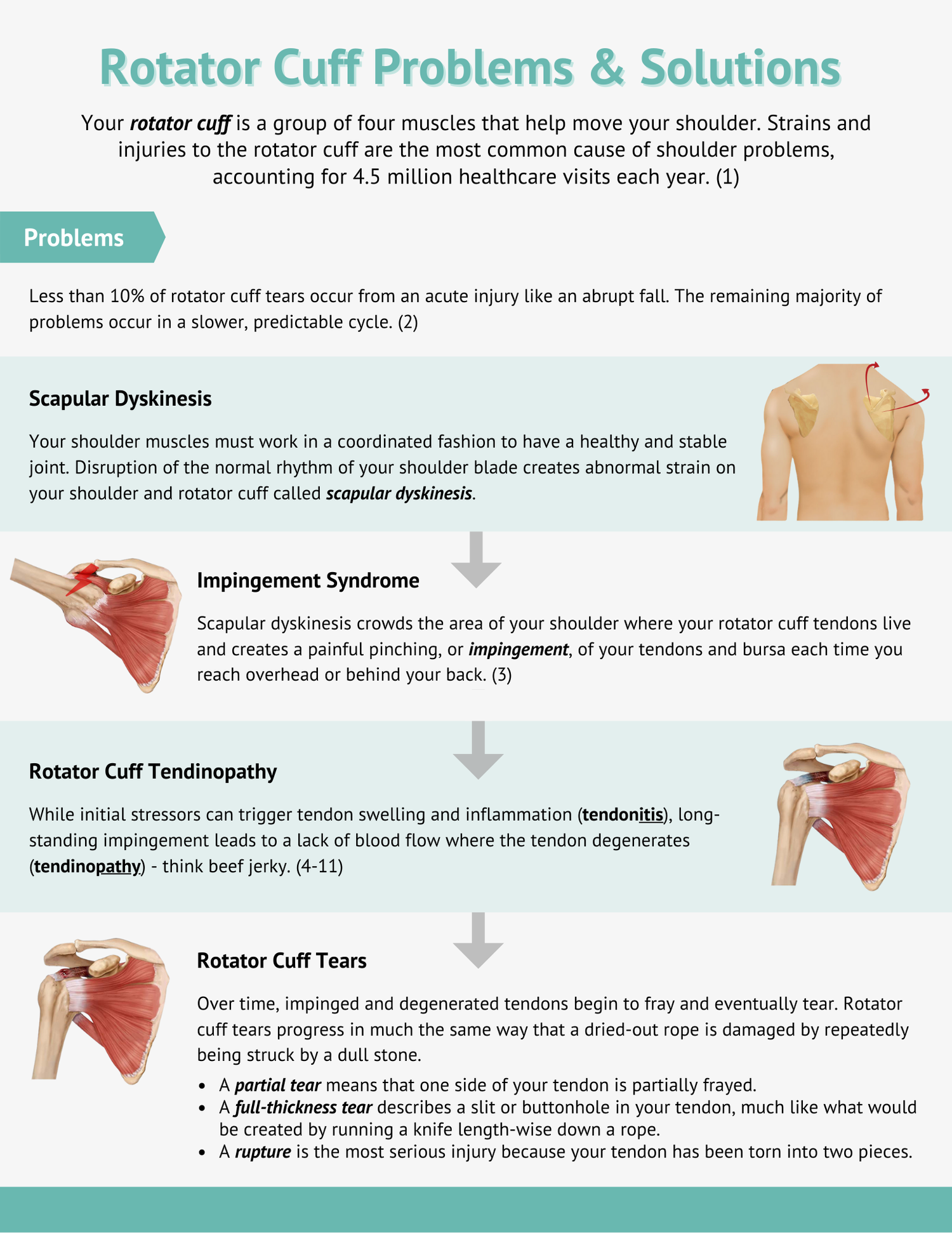 Rotator Cuff Tears: When to MRI & When to Refer — ChiroUp