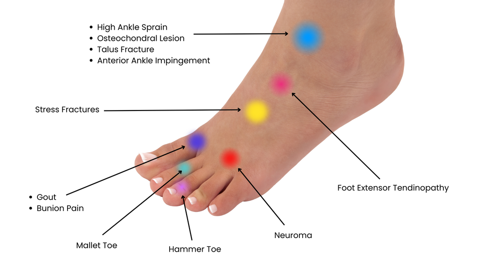 Mastering the Foot and Ankle Exam: A Step-by-Step Guide for ...