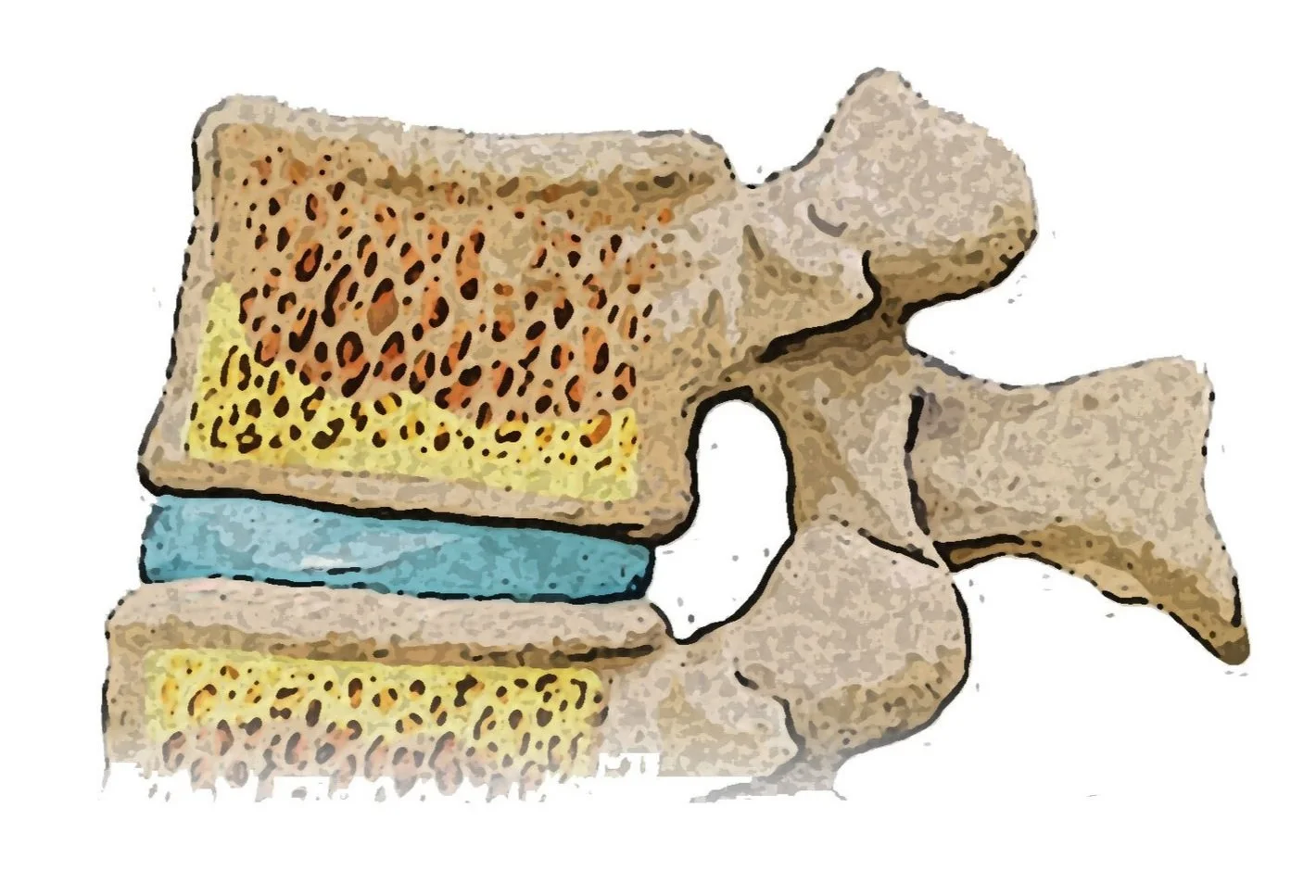 Demystifying Modic Changes - Your Ultimate 5-minute Guide — ChiroUp