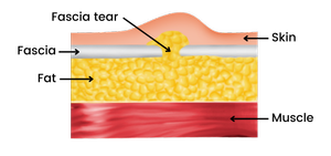 Top 7 Things Chiropractors Need to Know About Back Mice (Episacral ...