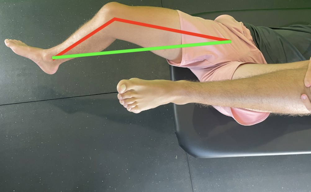 Performing the Modified Thomas Test (Part I) — ChiroUp