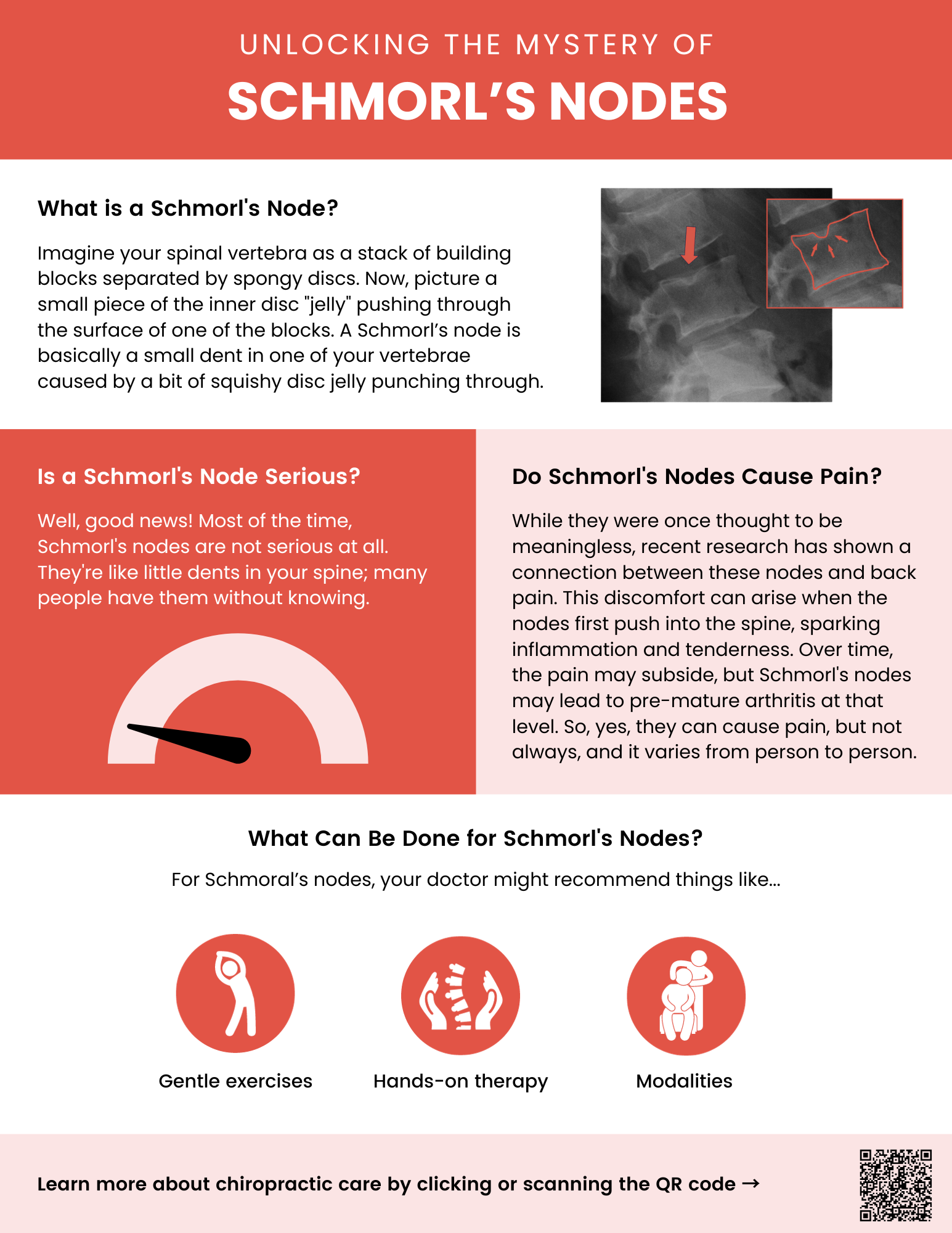 Schmorl’s Node Refresher: 7 Surprising Facts Every DC Must Own — ChiroUp