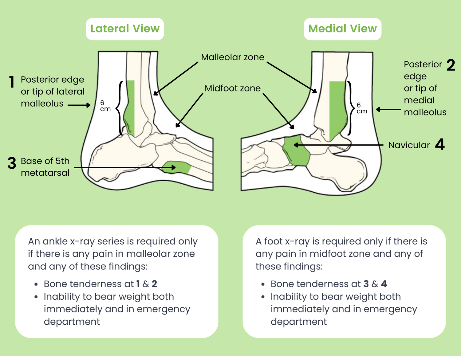 The Ottawa Ankle Rules — ChiroUp