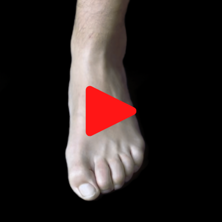 Plantar Fasciosis: 3 Ways to Identify Weakness in the Foot — ChiroUp