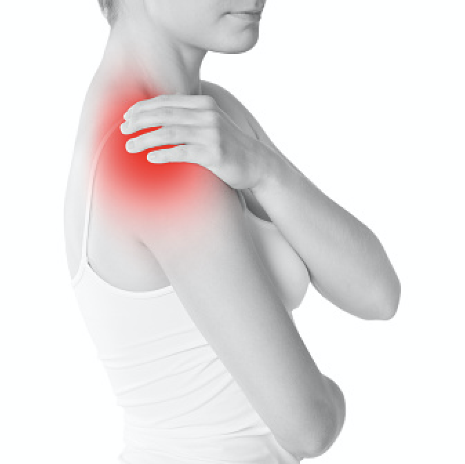 4 Frequently Missed Shoulder Pain Diagnoses — ChiroUp