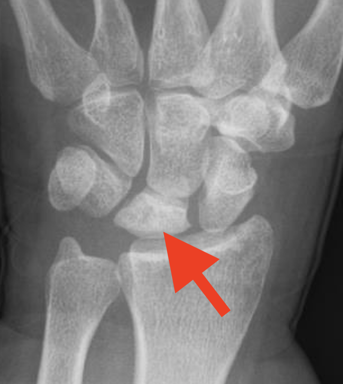 Chiropractic Hand And Wrist Physical Exam — ChiroUp