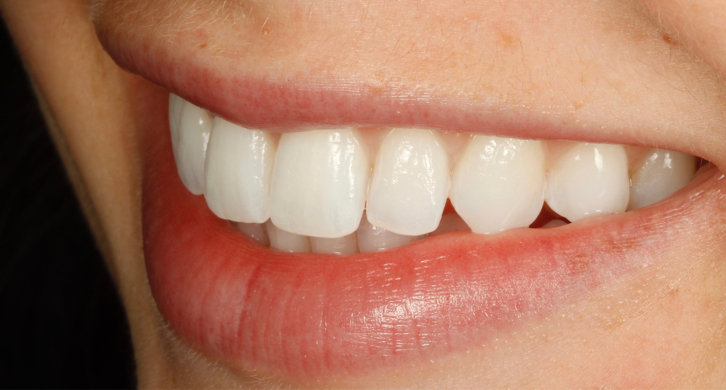 Get in contact for quality, affordable, teeth straightening with ...