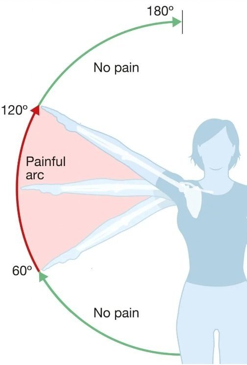 Shoulder Impingement Exercises - The Game Plan Physical Therapy