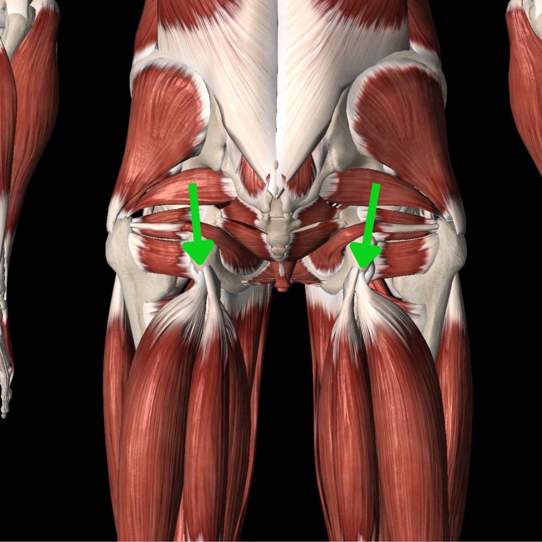 How to Treat Proximal Hamstring Tendinopathy - The Game Plan Physical ...