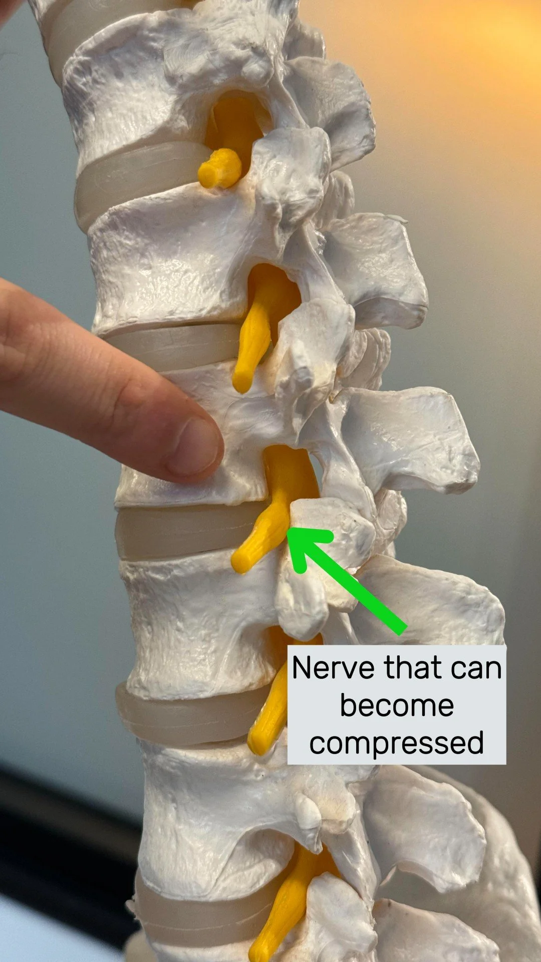 Physical Therapy for Sciatica - The Game Plan Physical Therapy