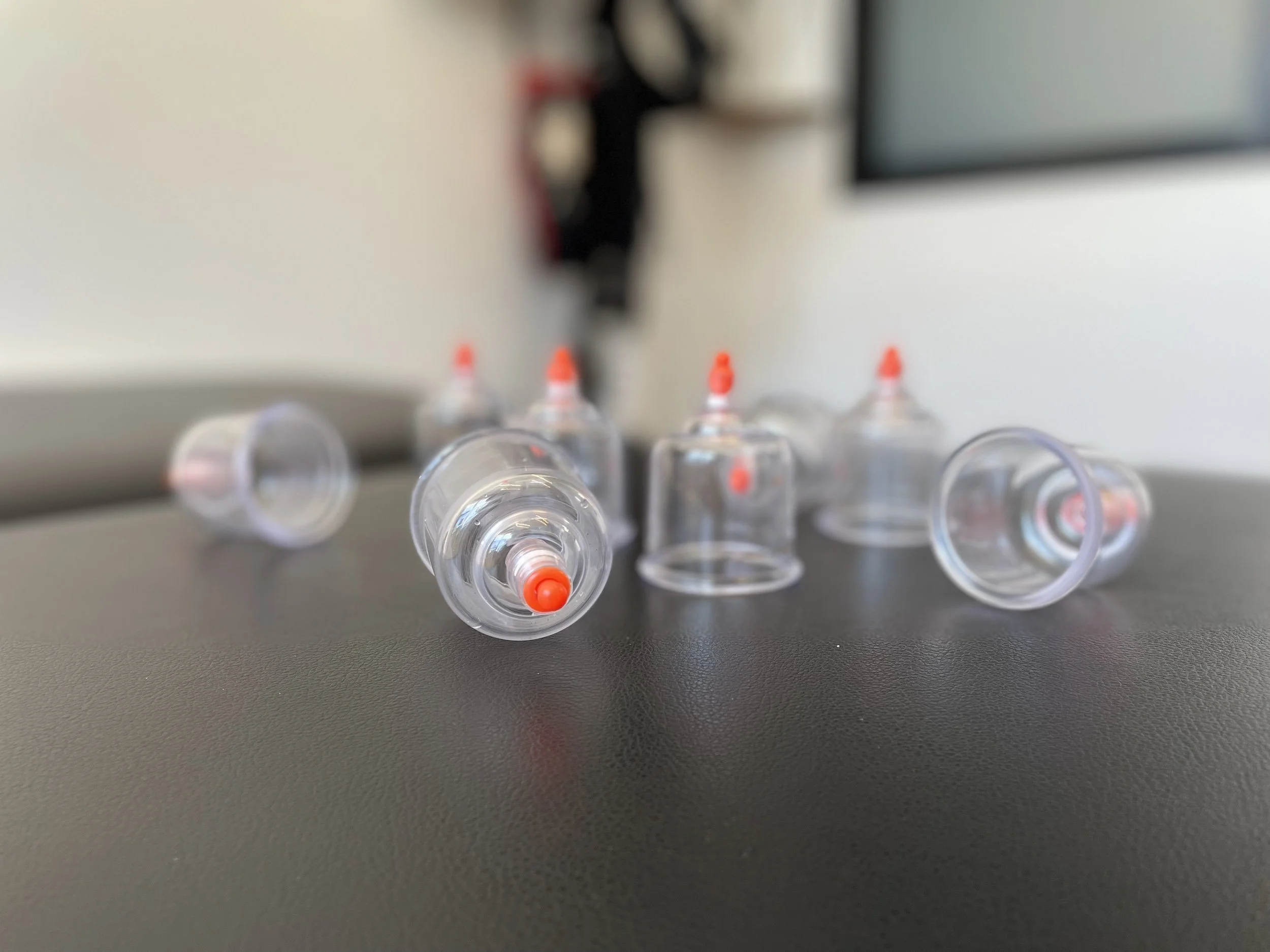 Cupping Therapy in Brooklyn, NYC - The Game Plan Physical Therapy