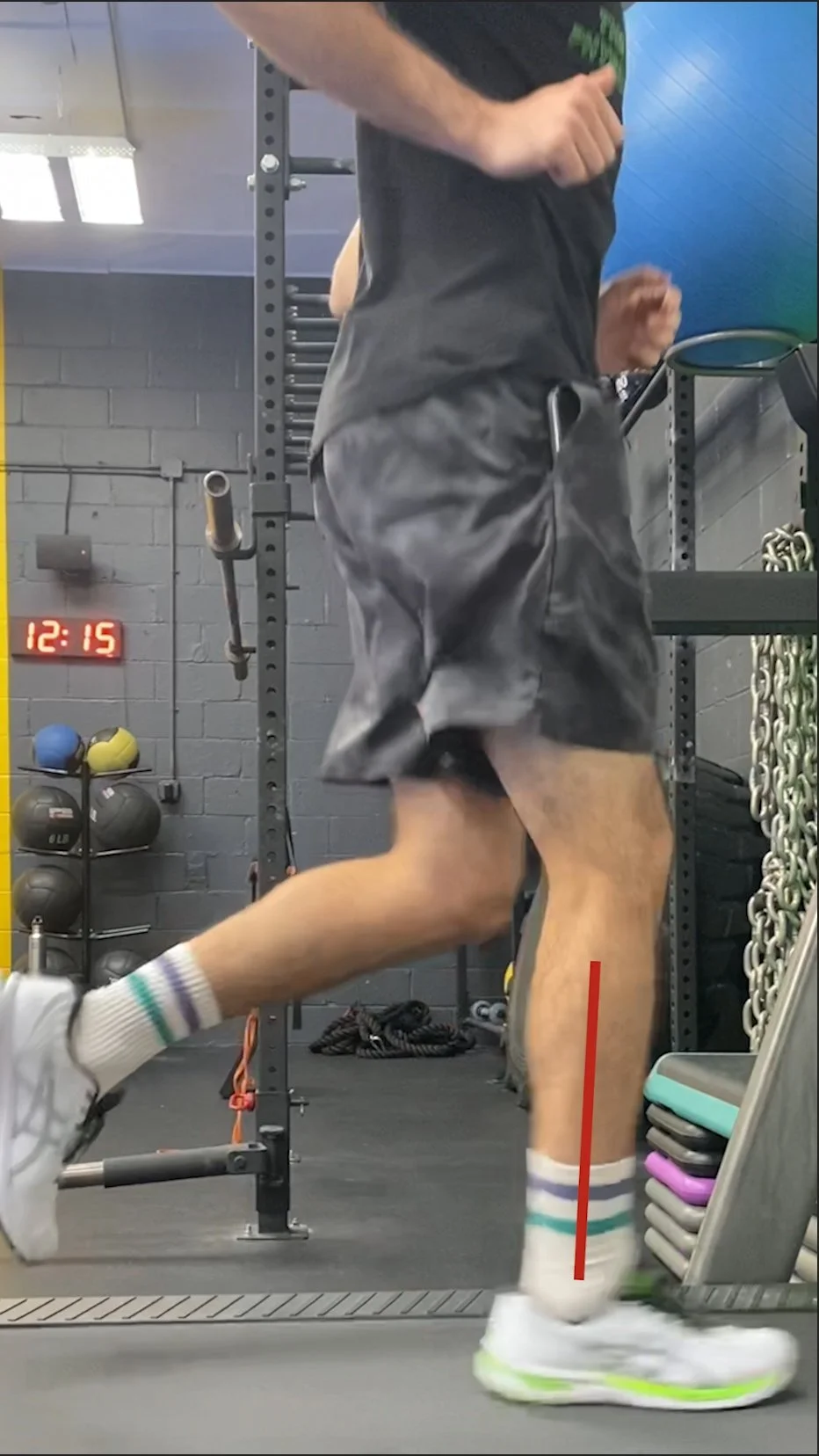 How to Fix Runner's Knee - The Game Plan Physical Therapy