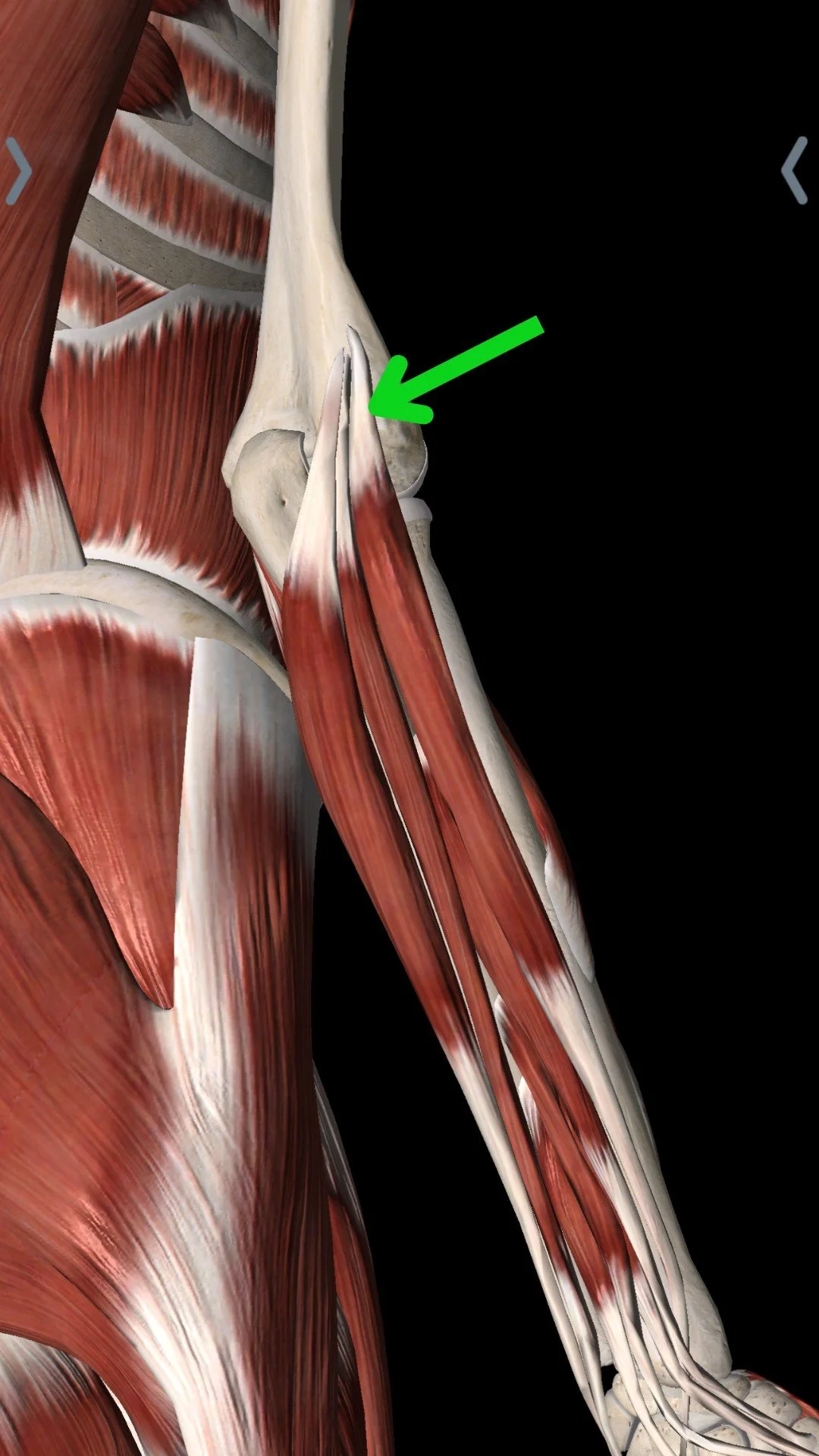 Physical Therapy for Tennis Elbow - The Game Plan Physical Therapy