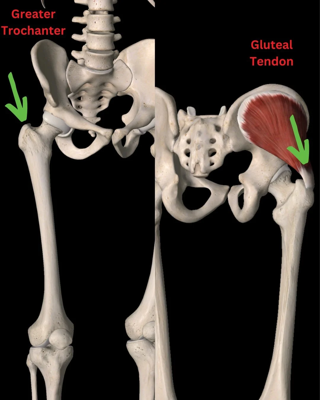 Hip Pain When Running? A Guide for Runners and How Physical Therapy Can ...