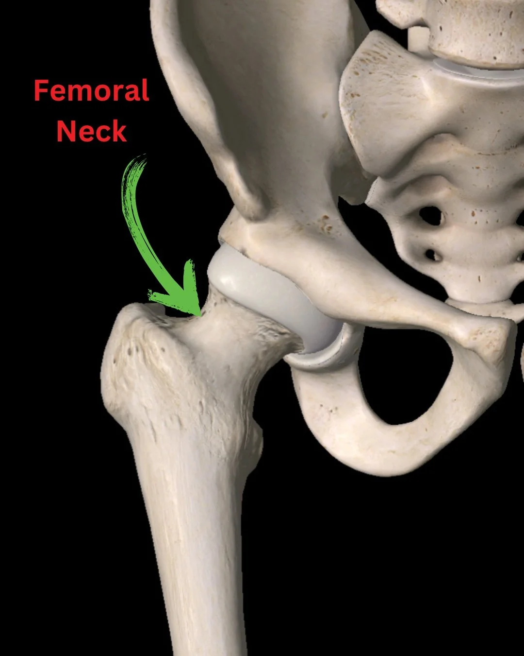 Hip Pain When Running? A Guide for Runners and How Physical Therapy Can ...