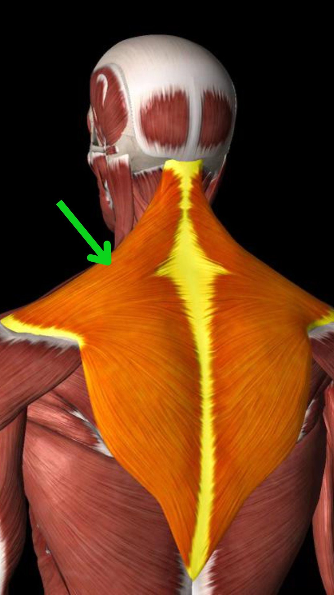 Cervicogenic Headache Exercises - The Game Plan Physical Therapy