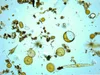 Innovative plankton monitoring tool holds key to assessing health of ...
