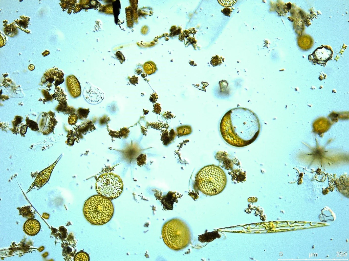 Innovative plankton monitoring tool holds key to assessing health of ...