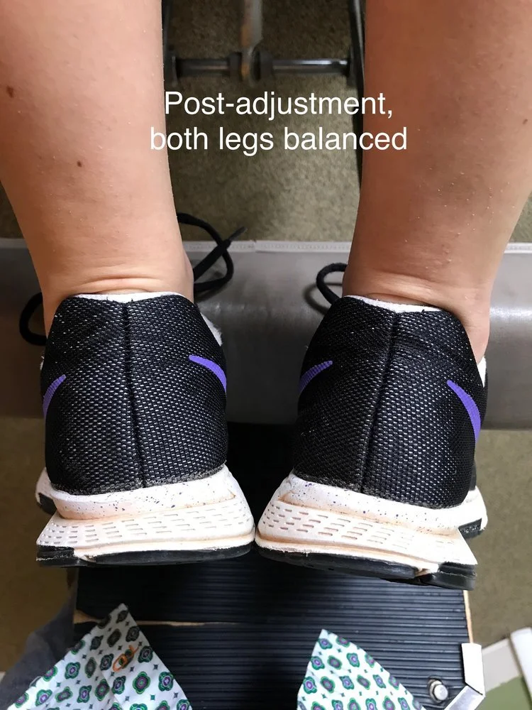 Leg Length Inequality — Hatten Family Chiropractic