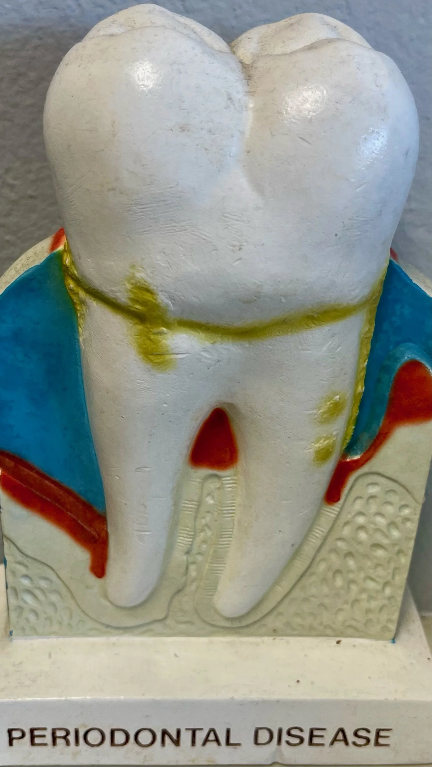 Periodontics — Castillo Dental Care