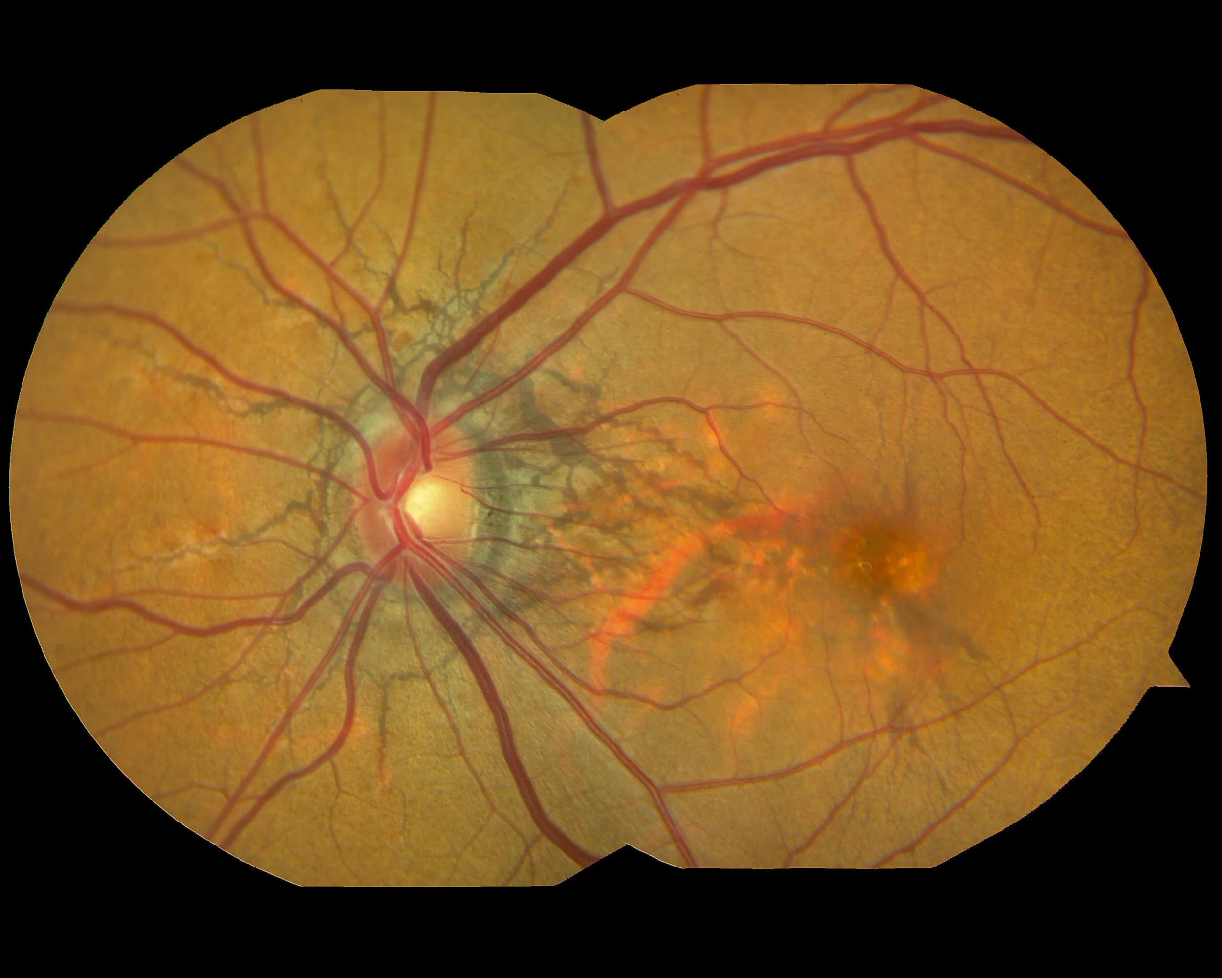 SEAN GROUT, CRA, OCT-C