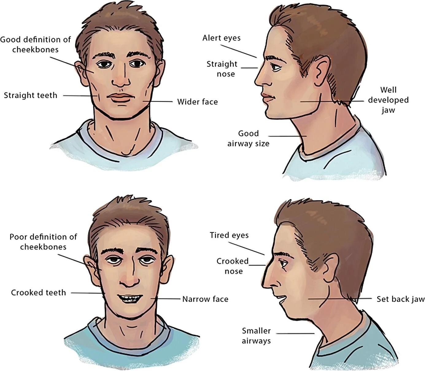 Nose vs Mouth Breathing: Facial Development & and Mewing — Coello