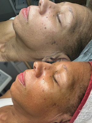 Estrogen and Skin Connection — AIR OF EARTH AESTHETICS