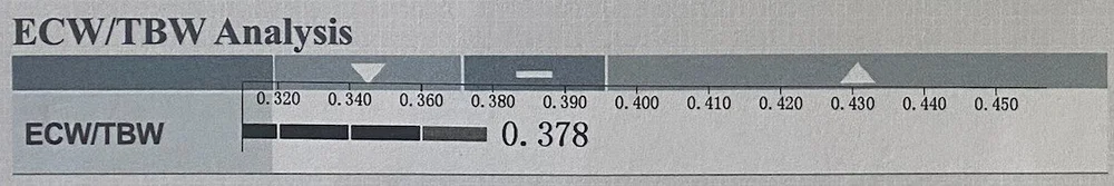 body composition and body fat percentage — Lifestyle Health and Wellness