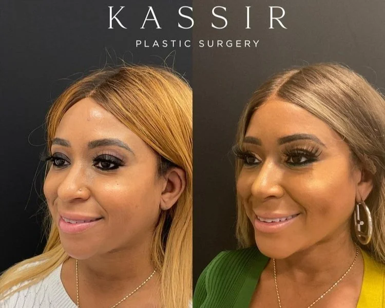 Bora Plastic Surgery