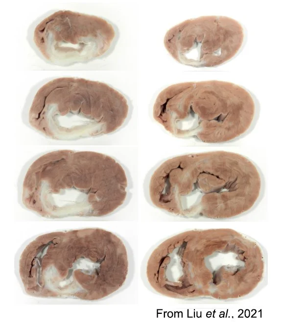 Martin Heart Lab - Texas Heart Institute | Biomedical Research