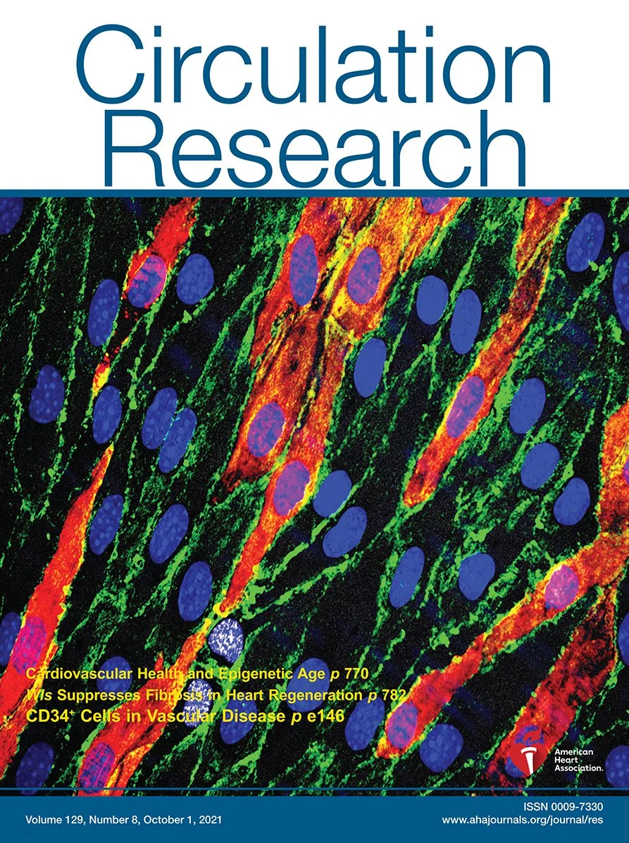 Featured Publications | Circulation Research - MARTIN HEART LAB