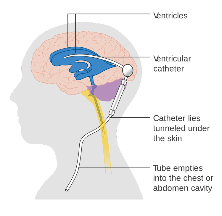 Lines, Leads, & Drains — In the ICU with Jessie Franco