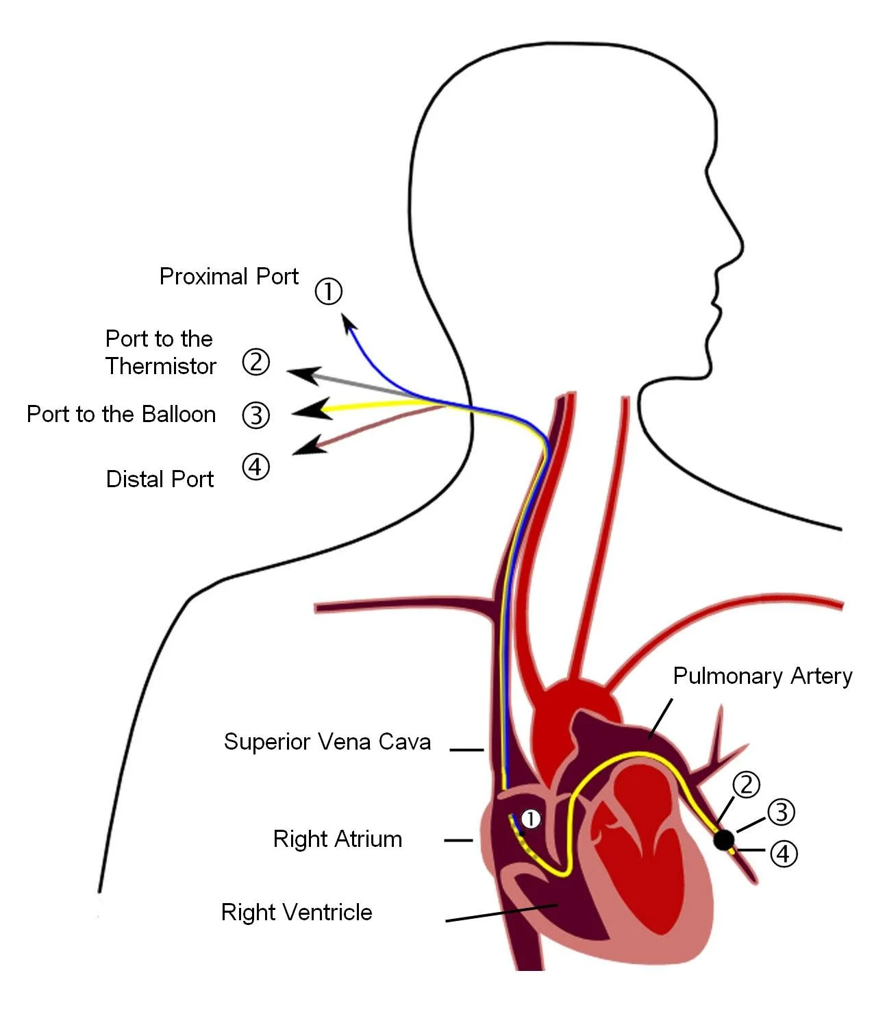 Lines, Leads, & Drains — In the ICU with Jessie Franco