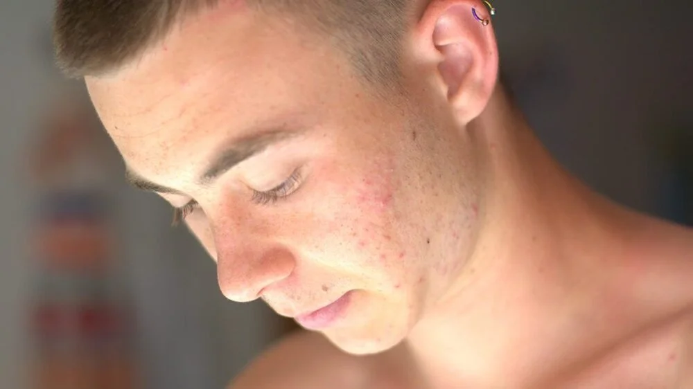 NATURALIS FACIAL REJUVENATION