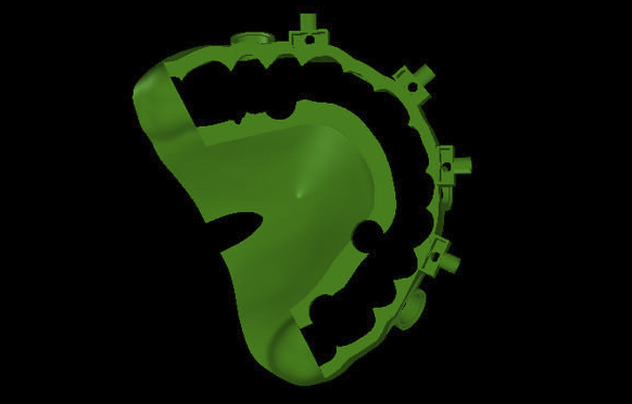 SGT Guides | Stackable Surgical Guides | Dental Implant Guided Surgery ...