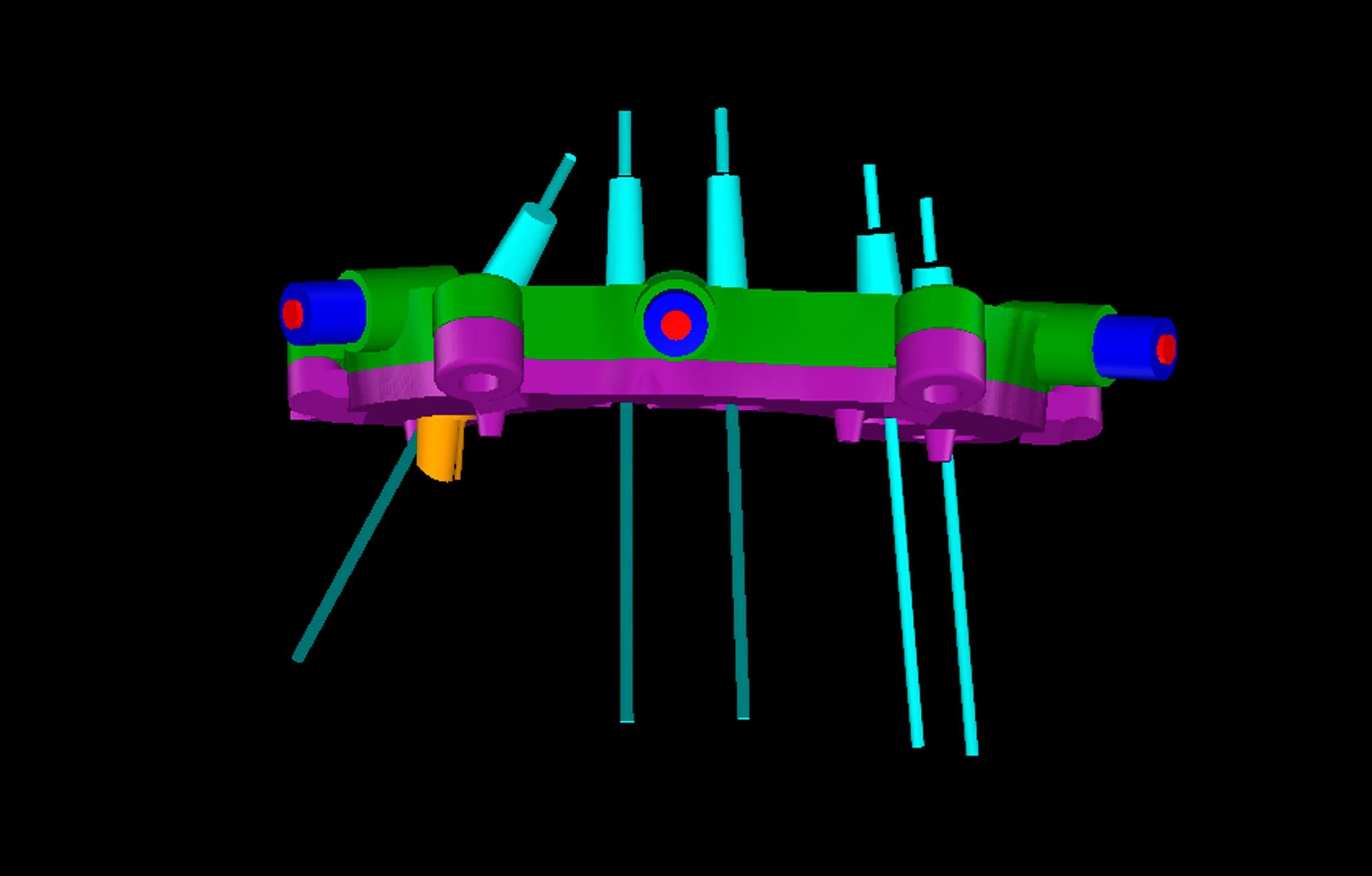 SGT Guides | Stackable Surgical Guides | Dental Implant Guided Surgery ...