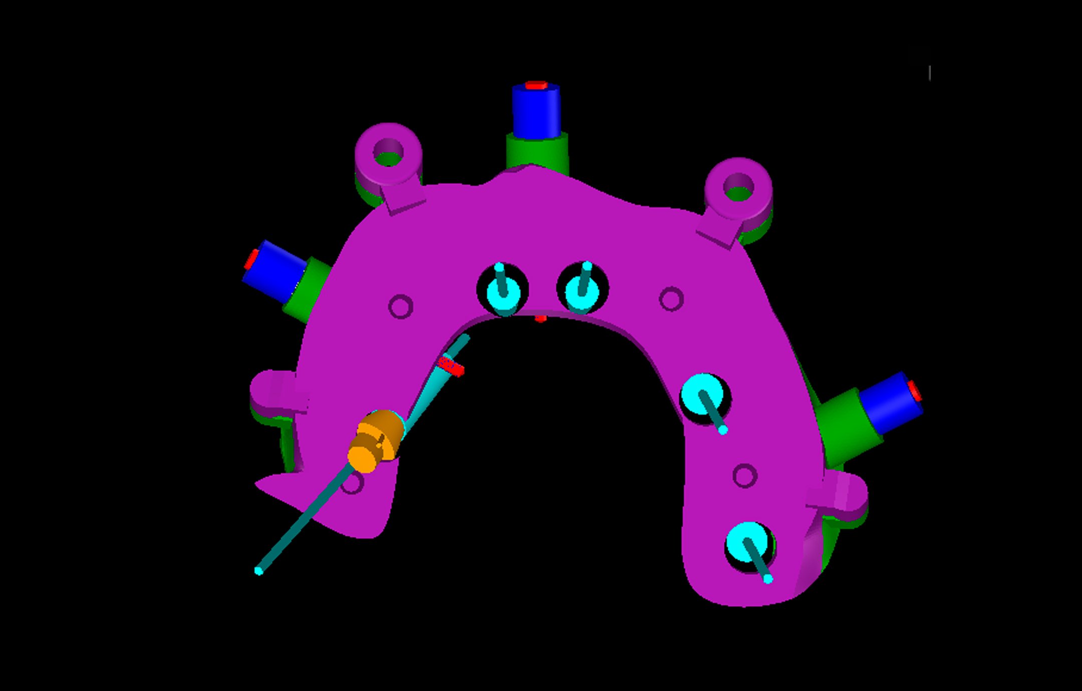 SGT Guides | Stackable Surgical Guides | Dental Implant Guided Surgery ...