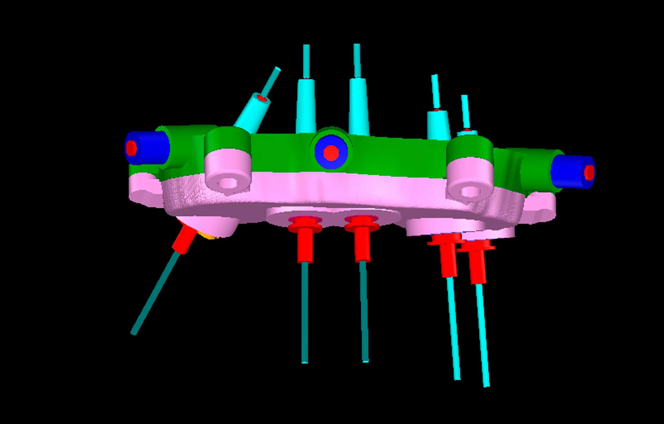 SGT Guides | Stackable Surgical Guides | Dental Implant Guided Surgery ...