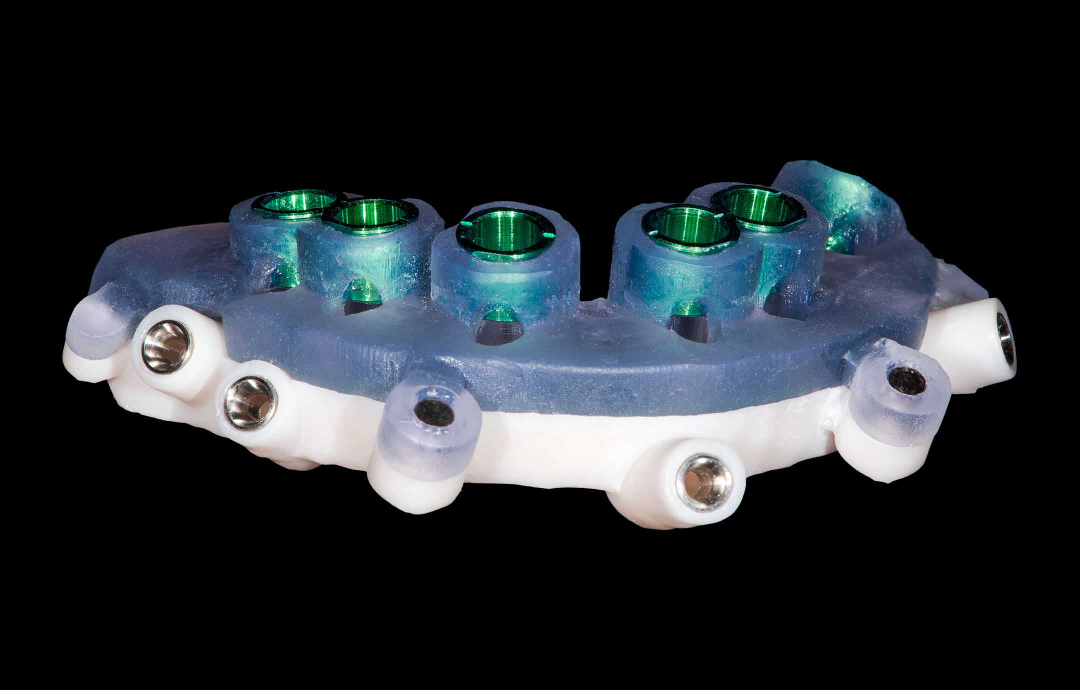 SGT Guides | Stackable Surgical Guides | Dental Implant Guided Surgery ...