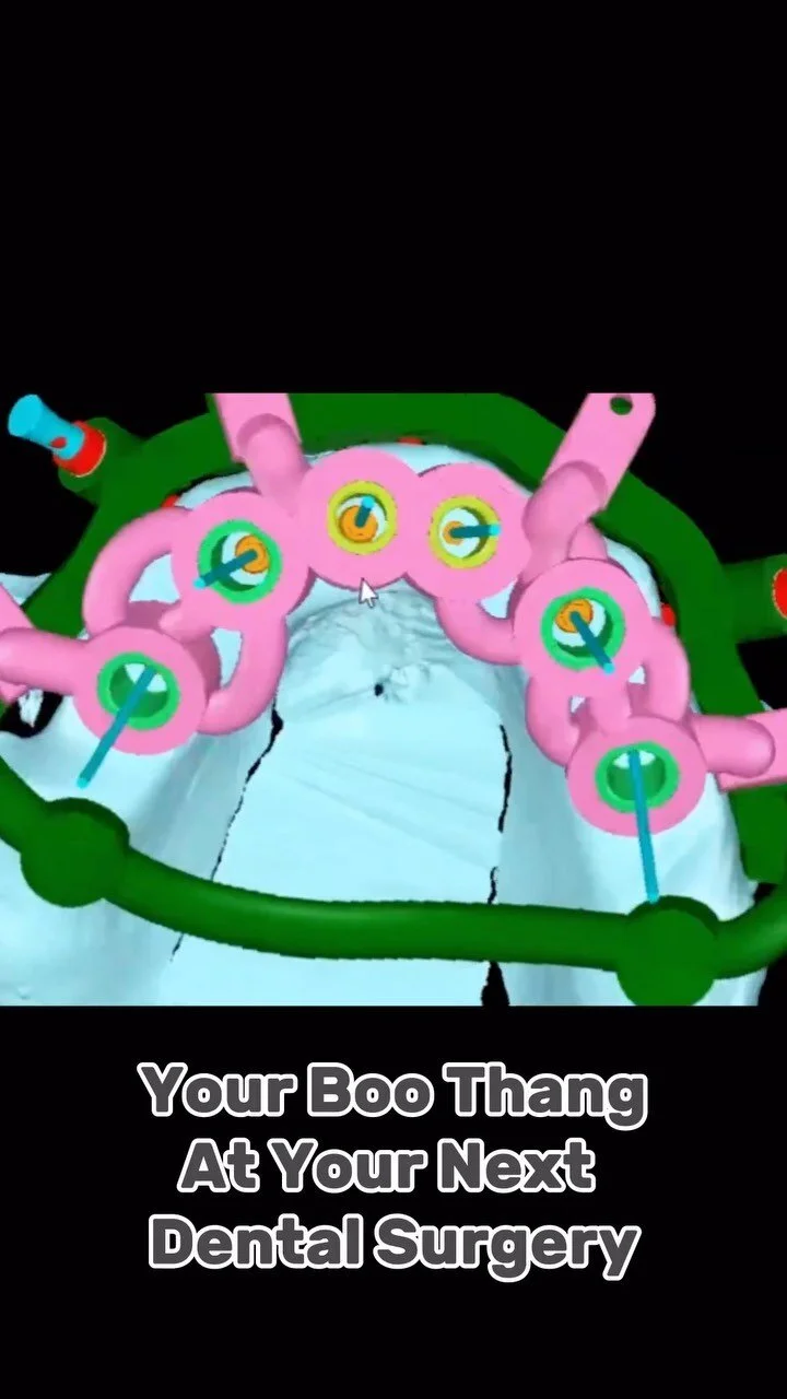 Why Are Stackable Surgical Guides Gaining Popularity? — SGT Guides ...