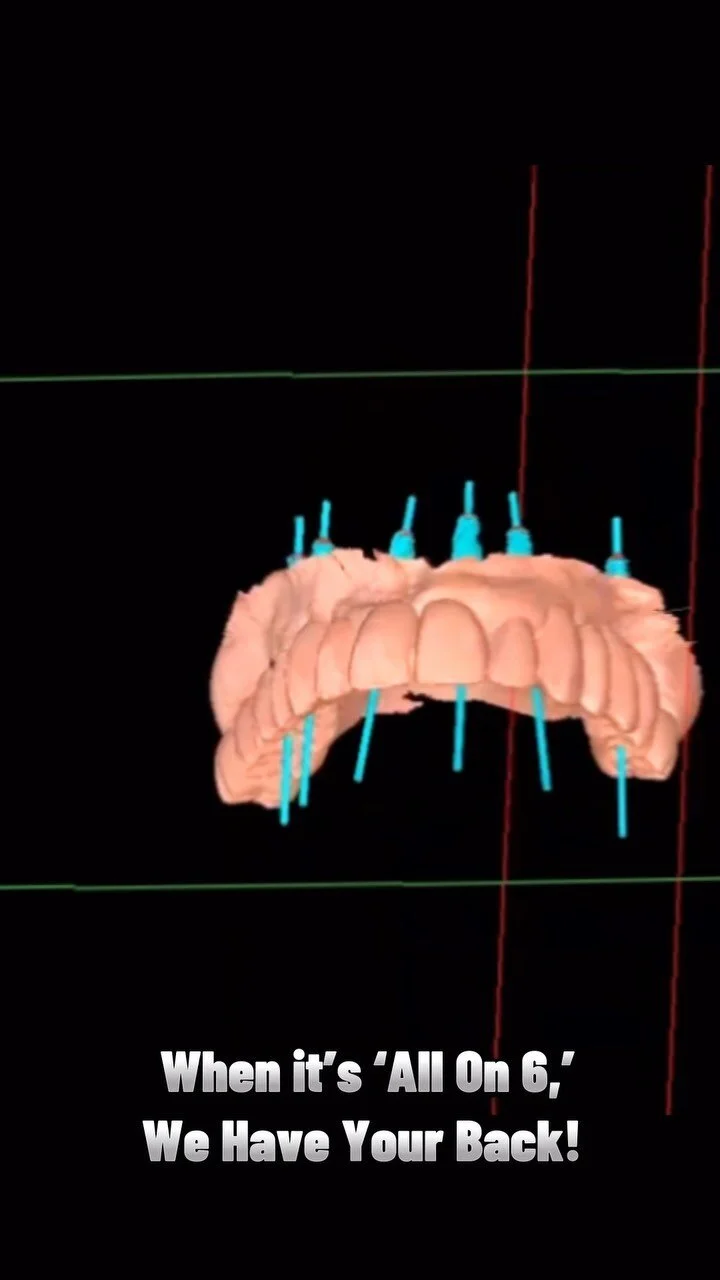 A Dental Laboratory's Guide To Effective Treatment Planning — SGT ...