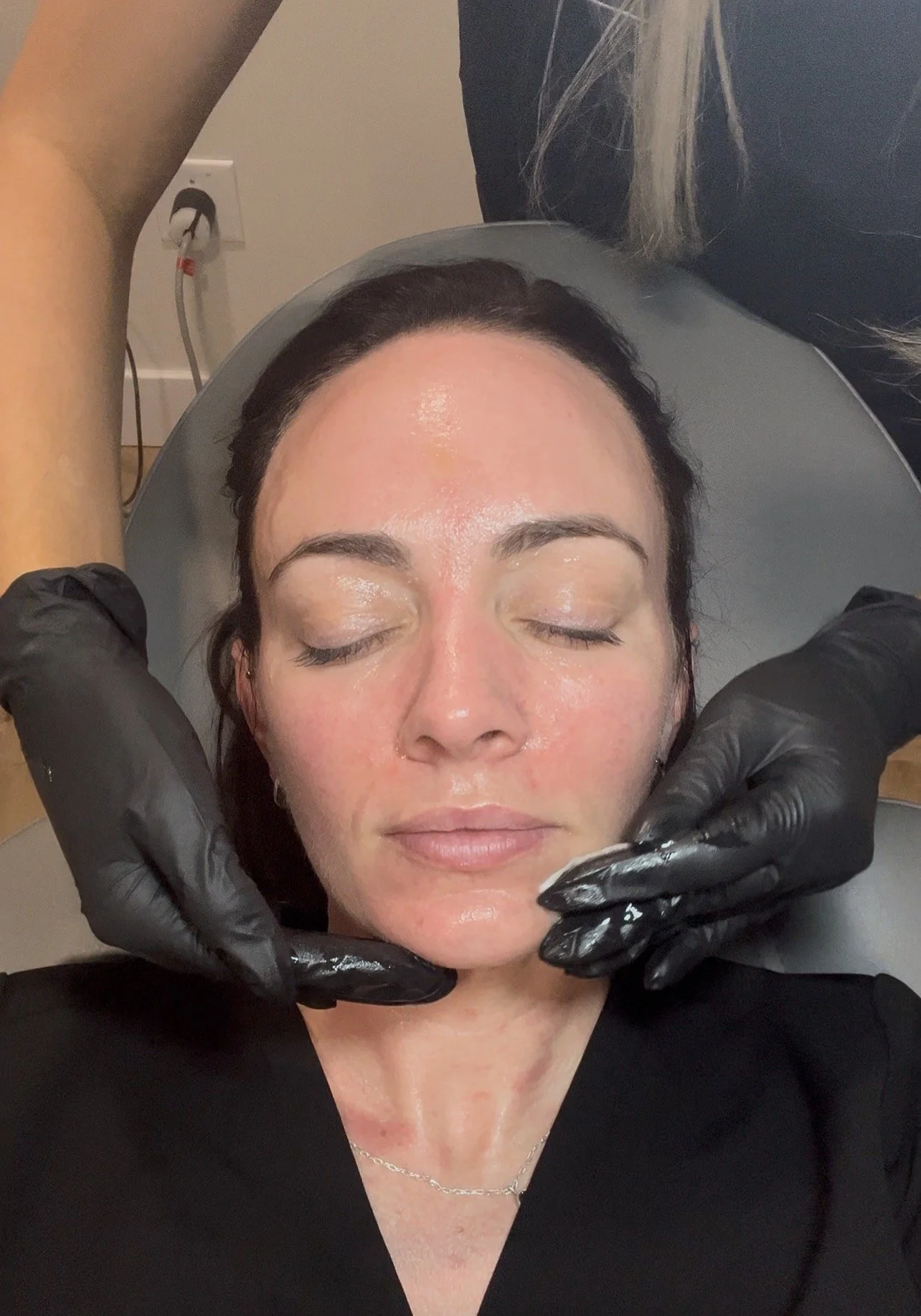 Aquafirme Facial in Clarkston, Michigan — Refresh & Renew MedSpa