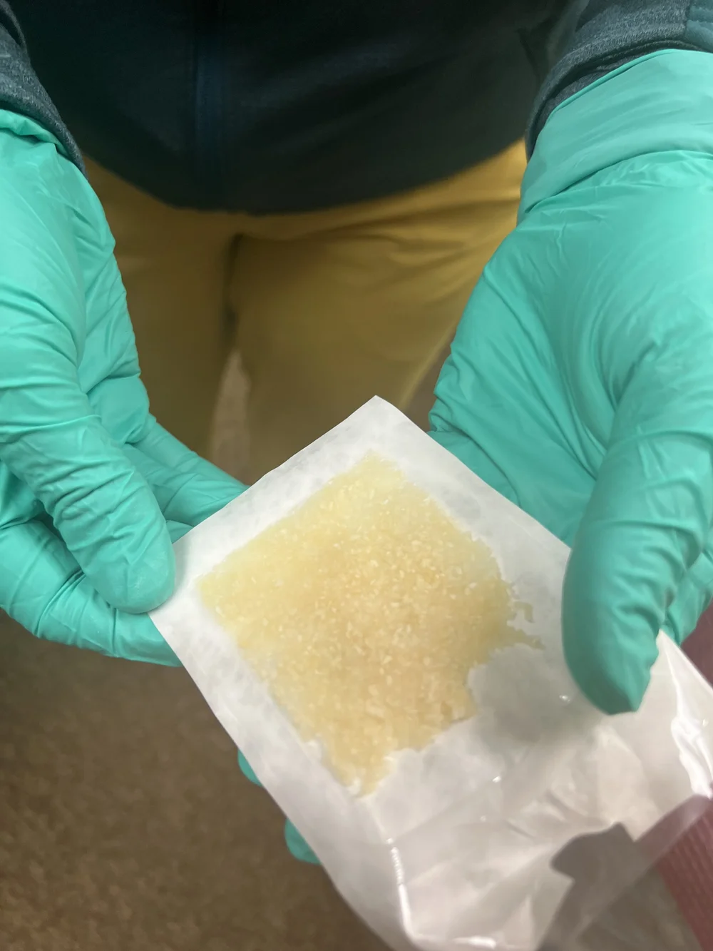 Innovating Wound Care: Harnessing The Healing Power Of Fish Skin At ...