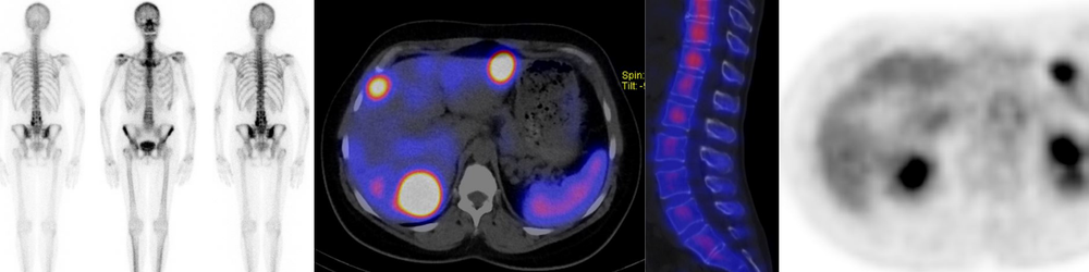 Nuclear Medicine & Dosimetry — BICL Boston Core Imaging Lab