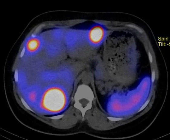 Nuclear Medicine & Dosimetry — BICL Boston Core Imaging Lab